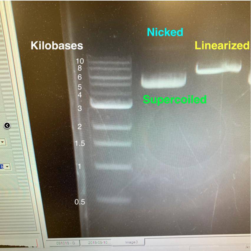 Plasmid Dna Gel Electrophoresis